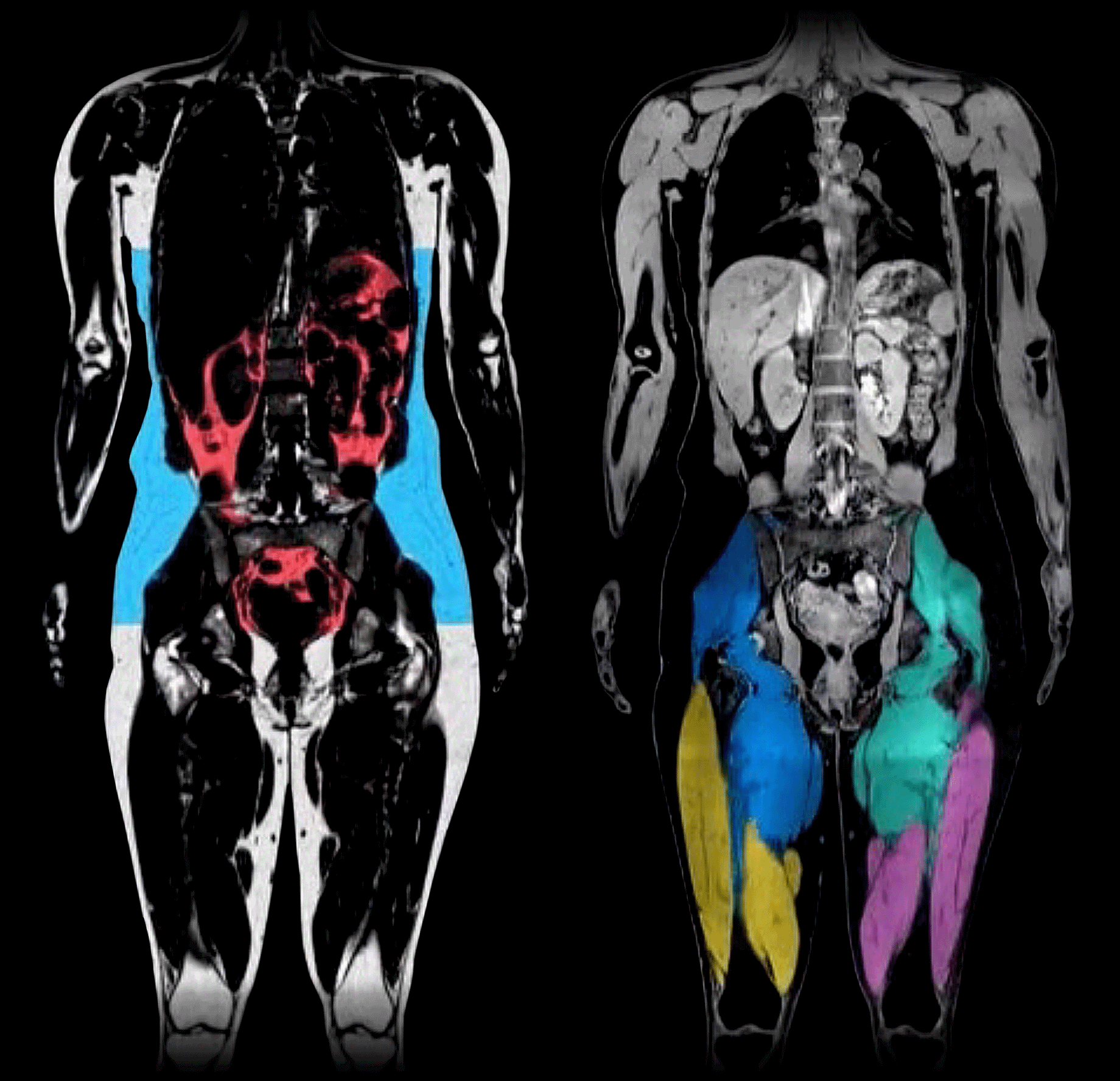 BCP Measurements | BCP